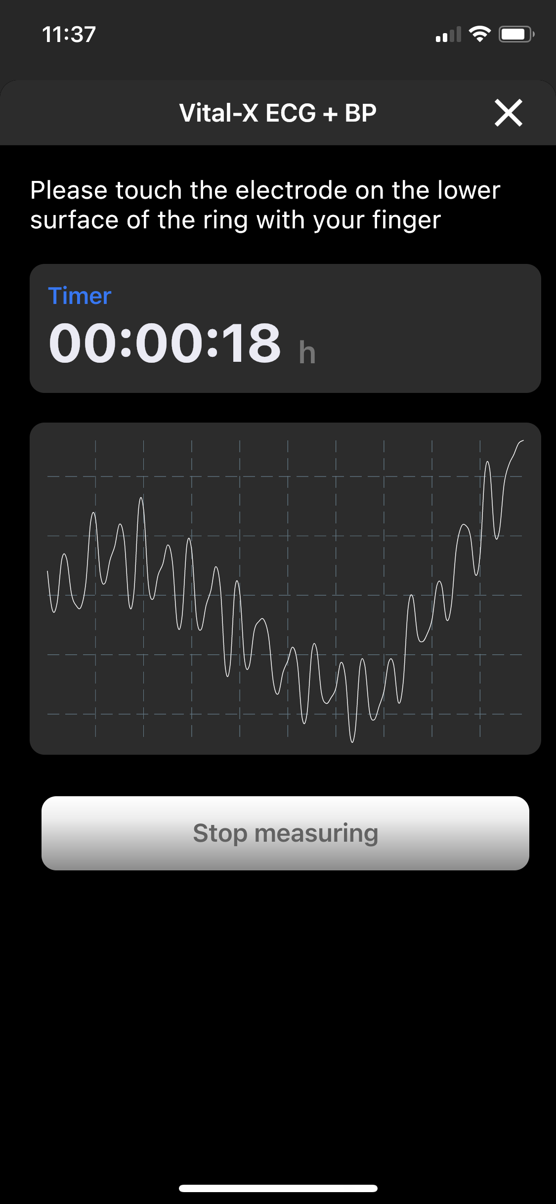 MCRC Vital X | Echtzeit-Monitoring | Art of Cryo